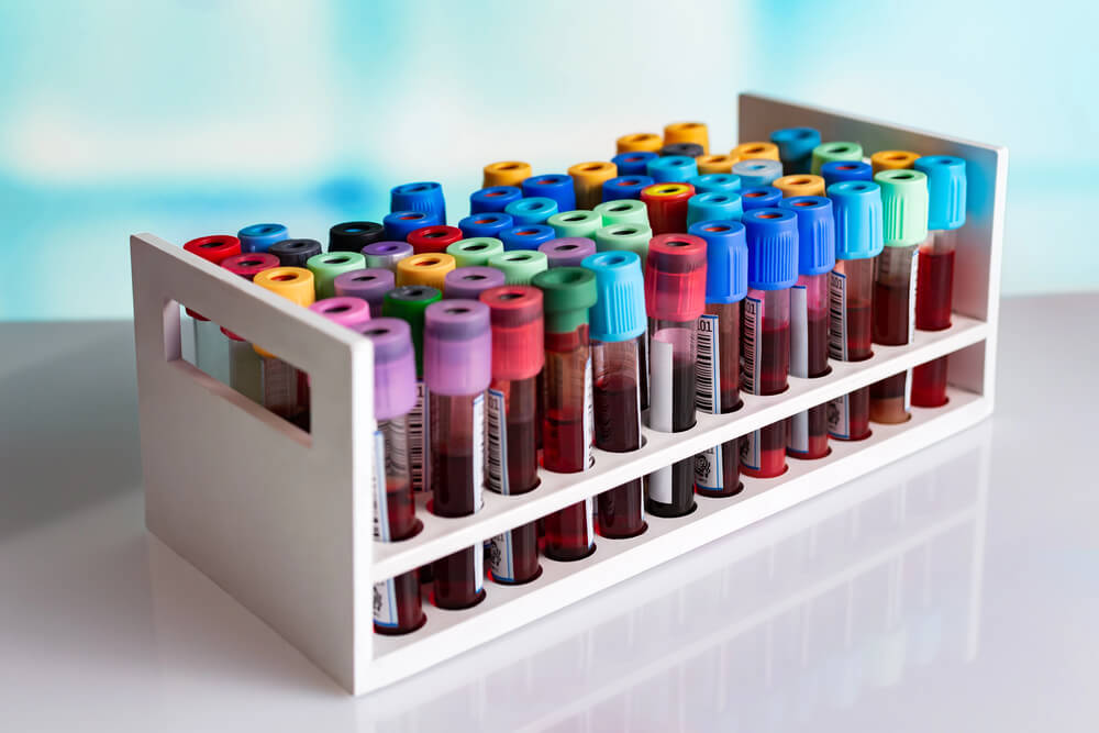 Choosing Lab Sample Trays: Types, Materials, and Other Considerations